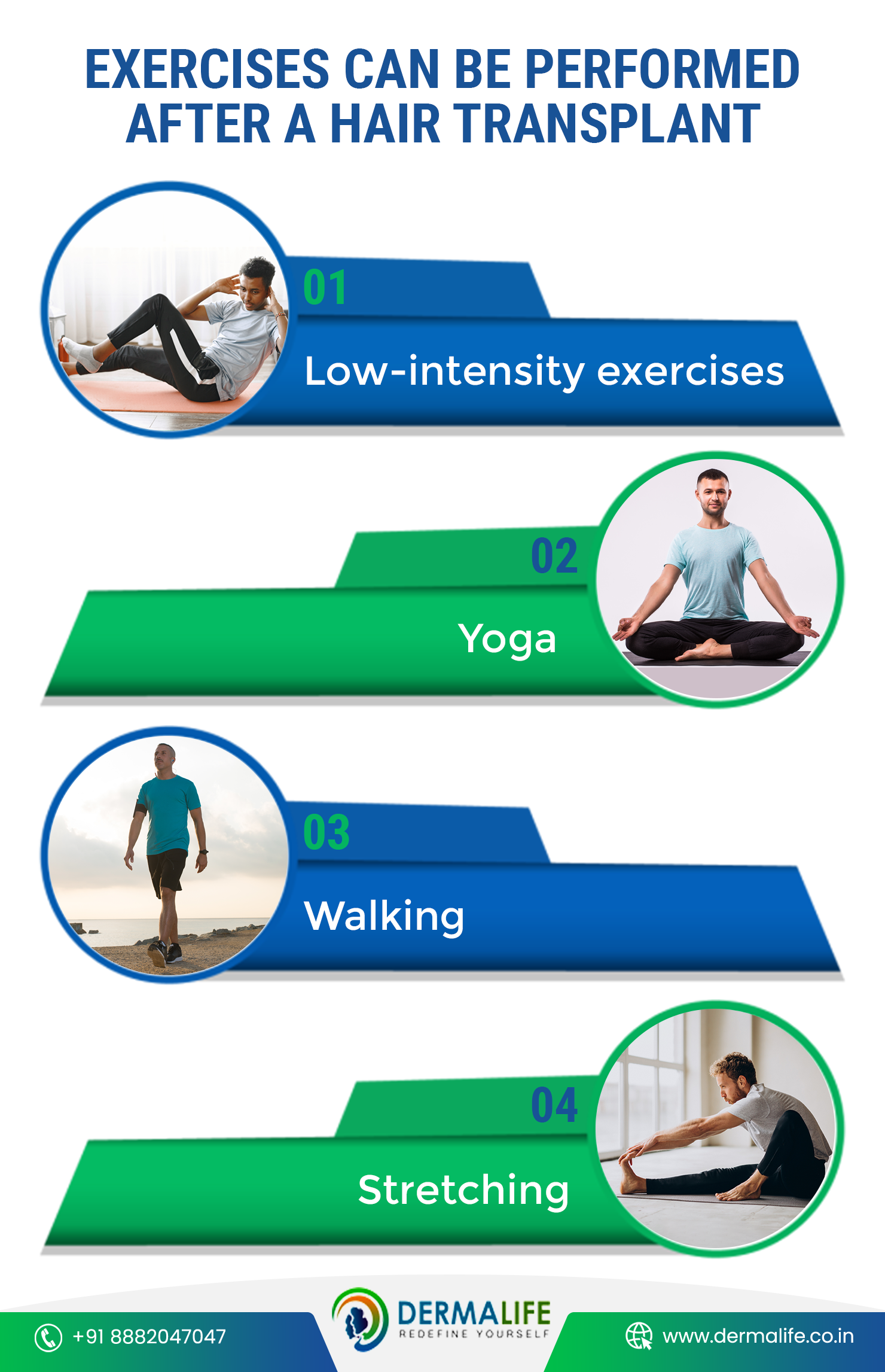 When Should You Exercise after Having a Hair Transplant?