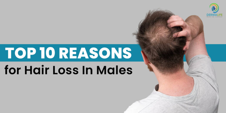 6 Exercises For Hair Growth Male and Female